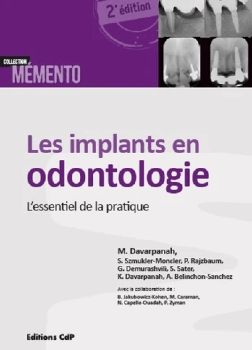Les implants en odontologie | Cabinet dentaire Davarpanah | Chirurgie ...