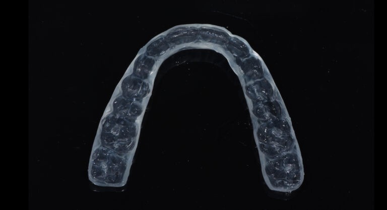 Gouttière de bruxisme | Chirurgien-dentiste Davarpanah