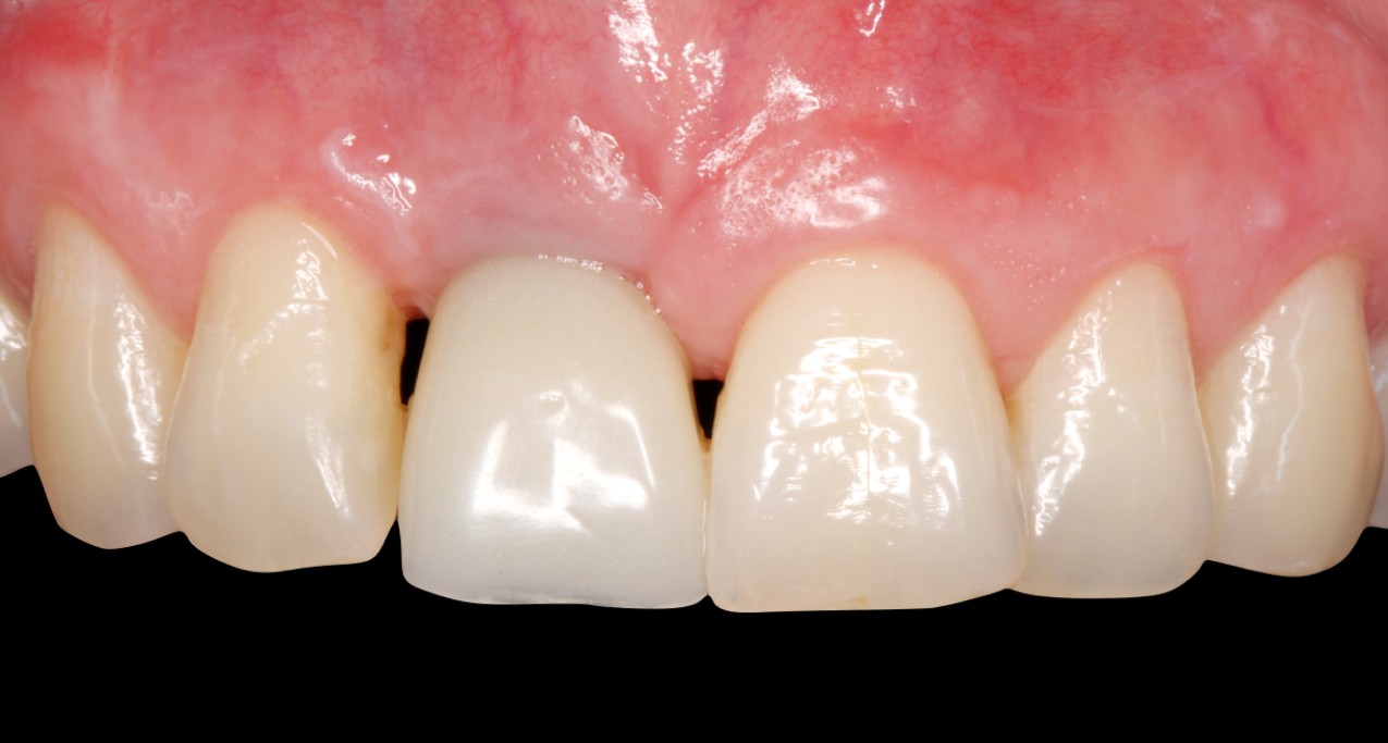 Réhabilitation globale et cas complexes pluridisciplinaires | Dr Davarpanah