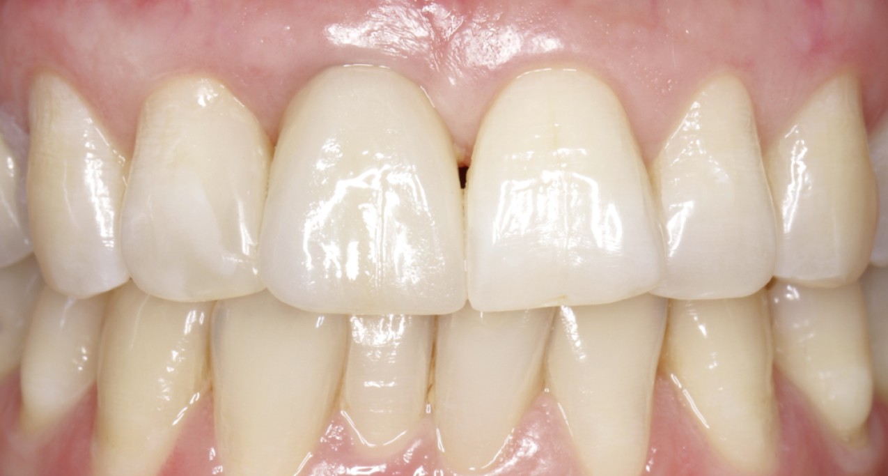 Réhabilitation globale et cas complexes pluridisciplinaires | Dr Davarpanah